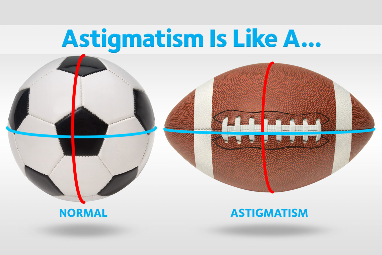 Astigmatism Correction with LazrPlastique® | Dr. Gulani’s Precision Surgery