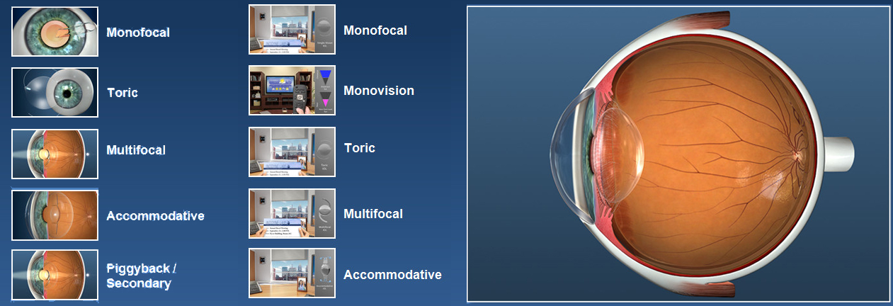 Cataract Surgery Jacksonville | Gulani Vision Institute