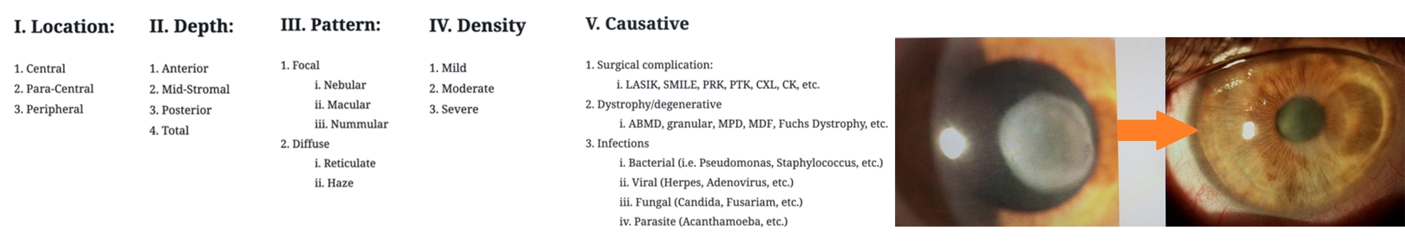 World’s Leading Expert in Corneal Scar Correction – Dr. Gulani in ...